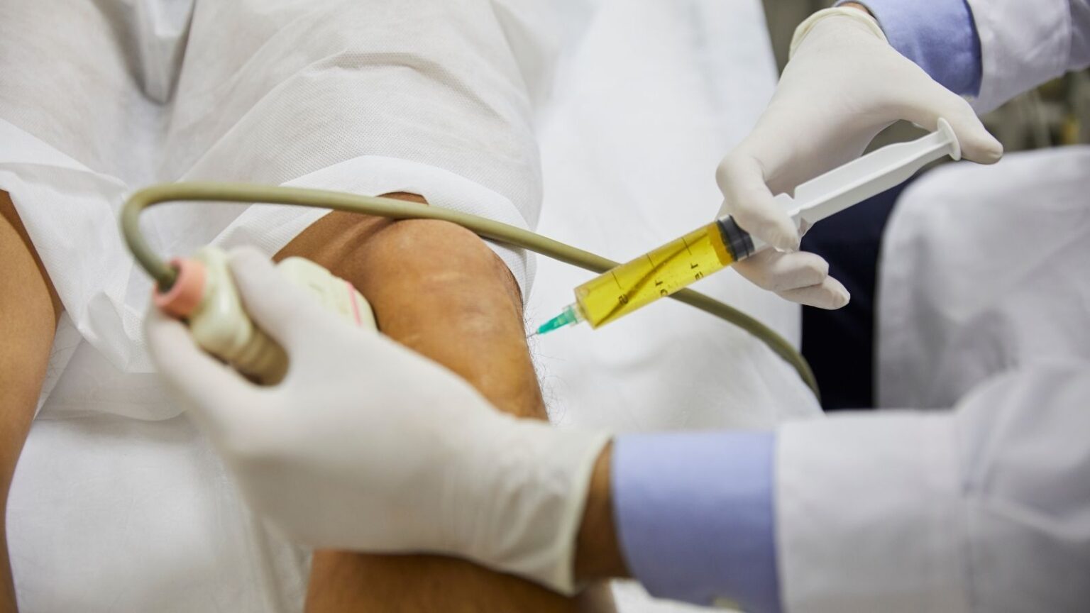 Sıvı Diz Protezi (Hidrojel) Yaptıranların Yorumları - Prof. Dr. Murat ...